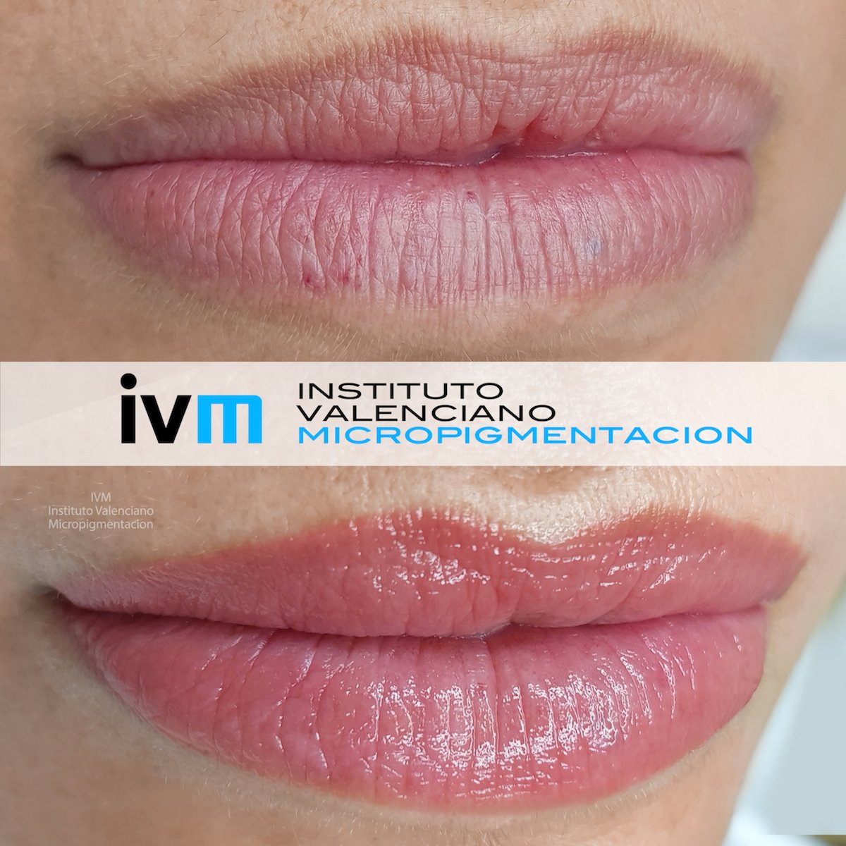 Labios | Micropigmentacionvalencia